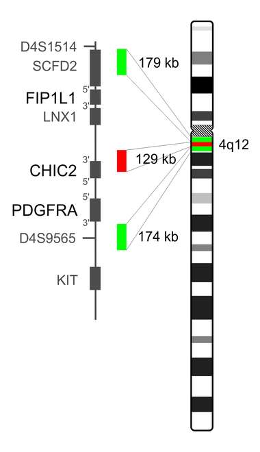 XL FIP1L1/CHIC2/PDGFRA - Deletion/Fusion Probe | MetaSystems Probes